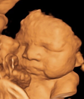 home - Precious Glimpse